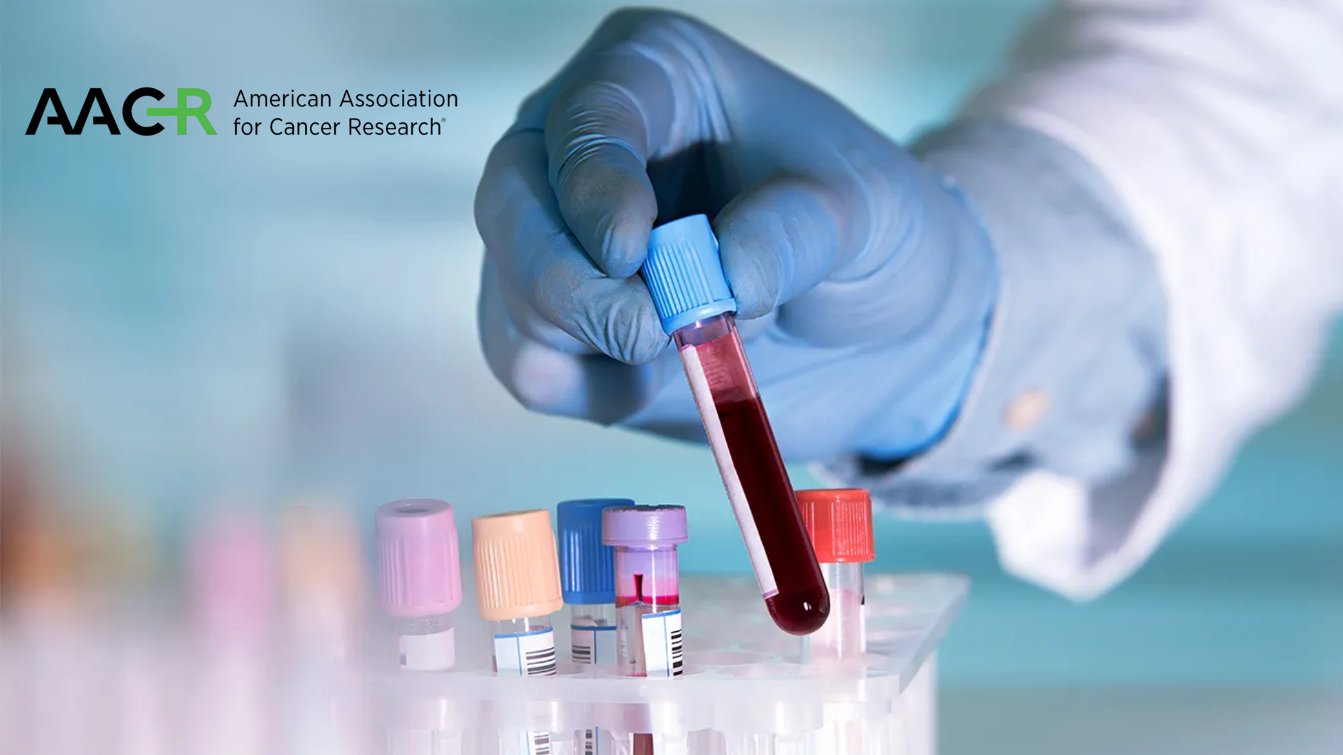 Study Shows ctDNA Liquid Biopsy Detects Colorectal Cancer Recurrence ...