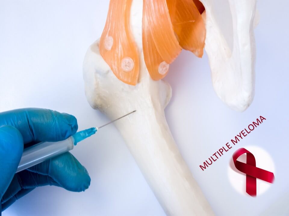 GSK’s anti-BCMA Therapy Notches FDA Approval for Refractory Multiple ...