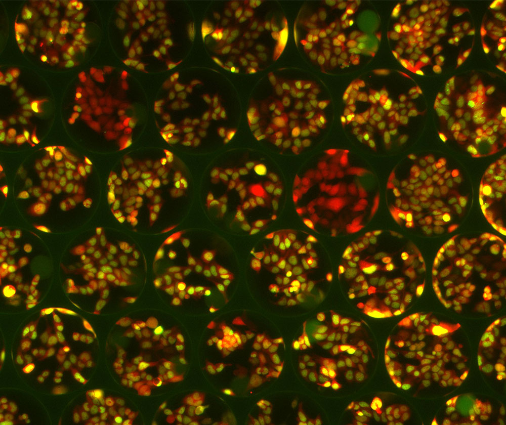 Plexium Bags $102 Million for Targeted Protein Degraders - GeneOnline News